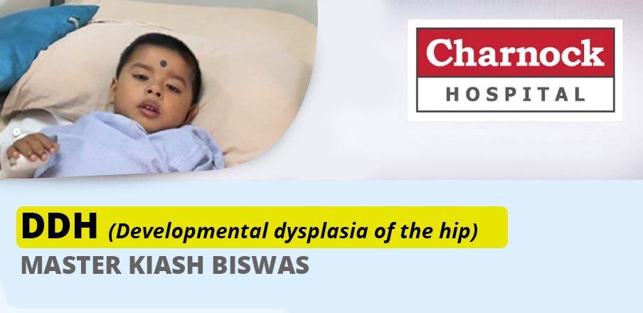 PATIENT'S REVIEW : DDH ( ORTHOPEDICS ) - Charnock